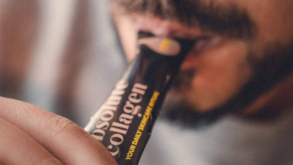 What is Male Pattern Hair Loss? | Eva Proudman | Absolute Collagen ...